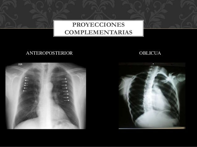 Proyecciones Radiologicas