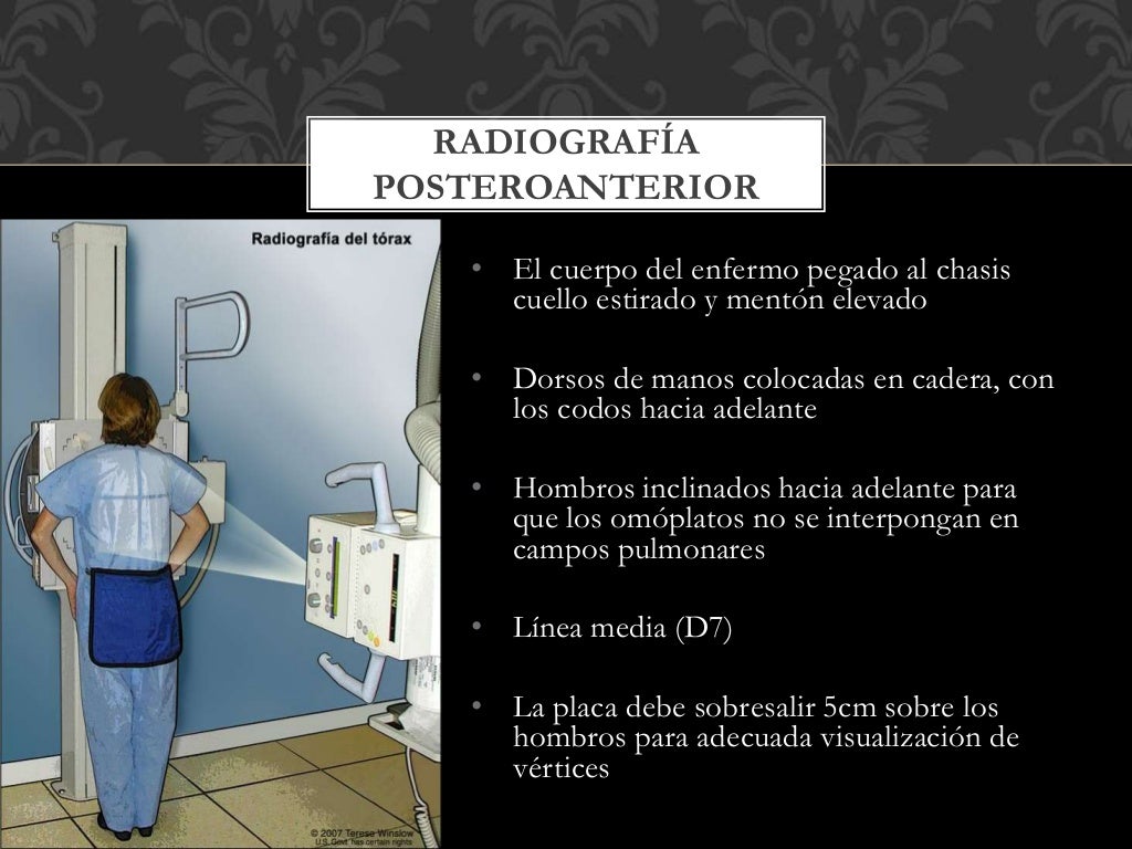 Proyecciones Radiologicas