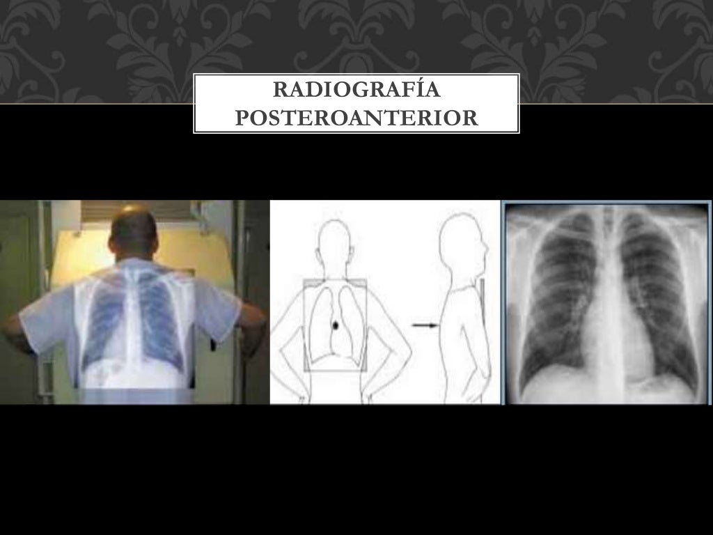Proyecciones Radiologicas