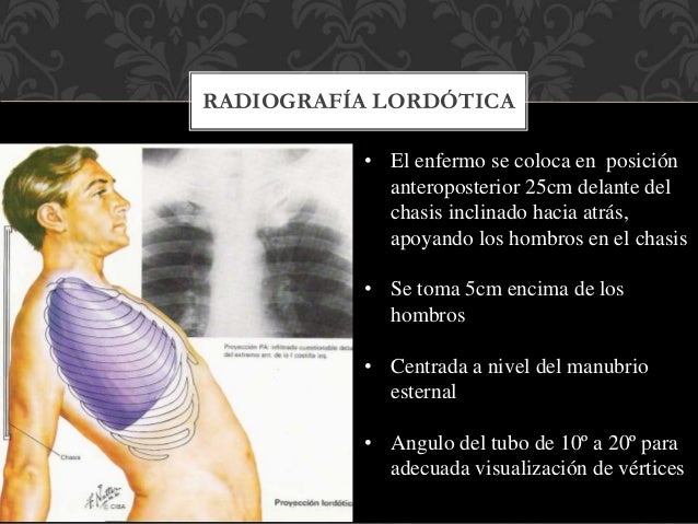 Proyecciones Radiologicas