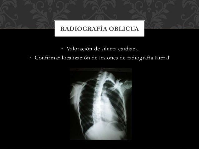 Proyecciones Radiologicas