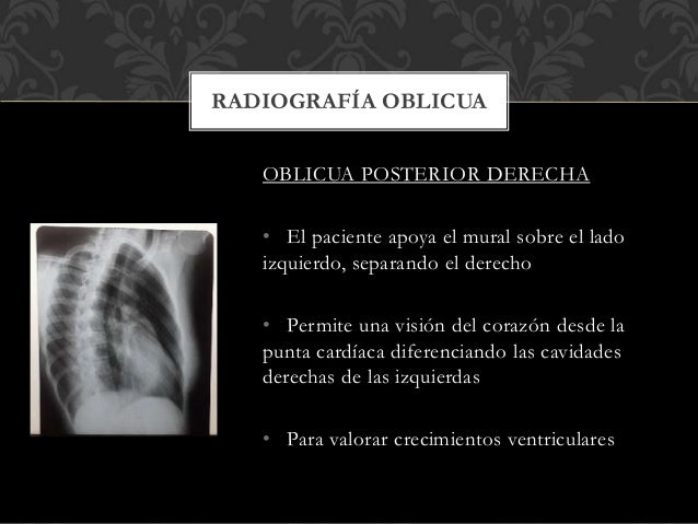 Proyecciones Radiologicas
