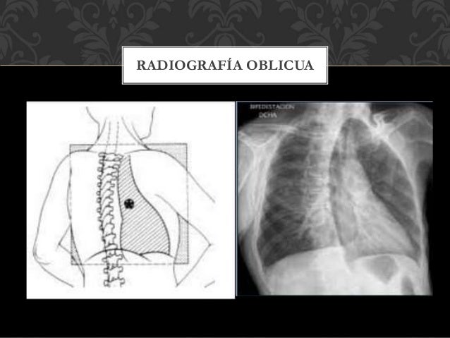 Proyecciones Radiologicas