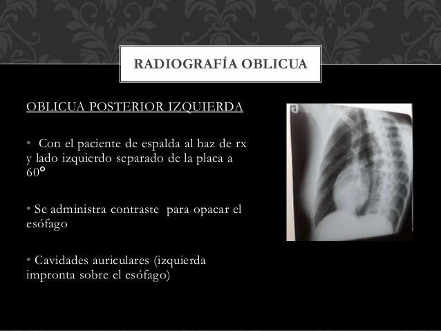 Proyecciones Radiologicas
