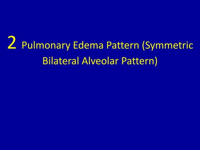 2 pulmonary edema pattern (symmetric bilateral alveolar | PPT