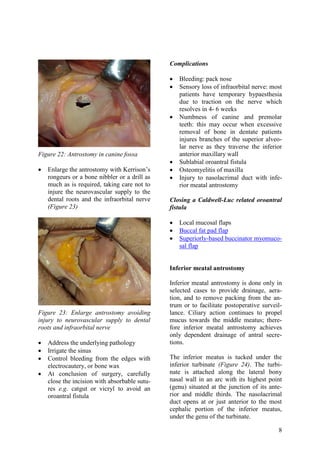 Caldwell Luc _radical antrostomy_ procedure canine fossa and inferior ...