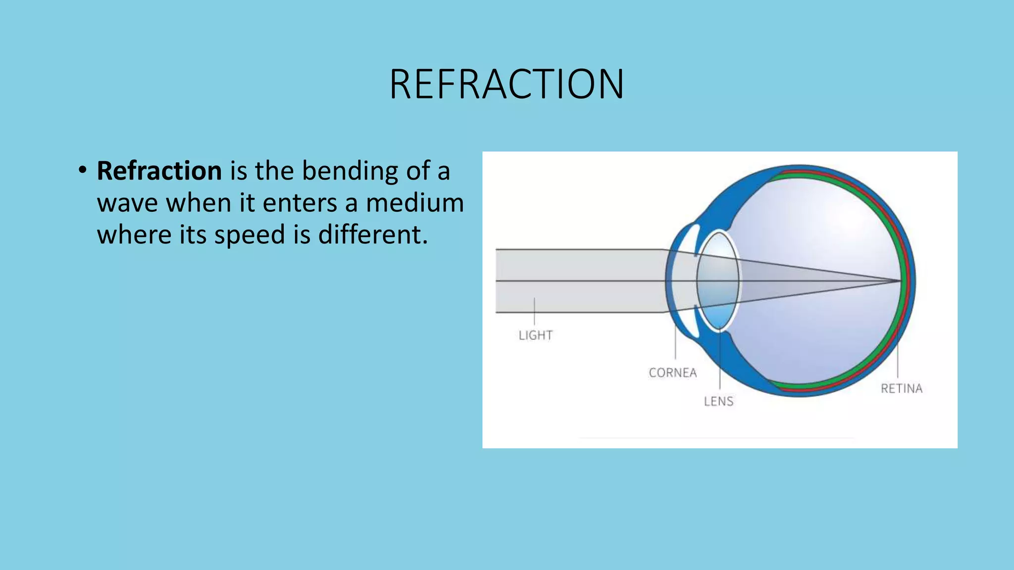 Refractive error | PPTX