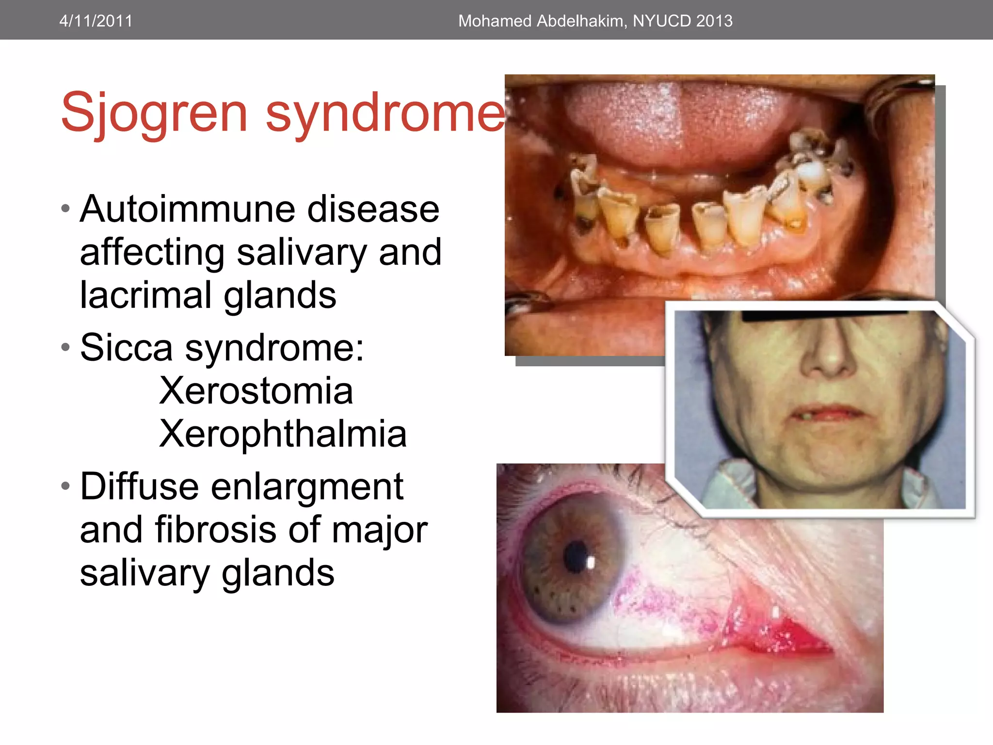 rheumatological diseases | PPT