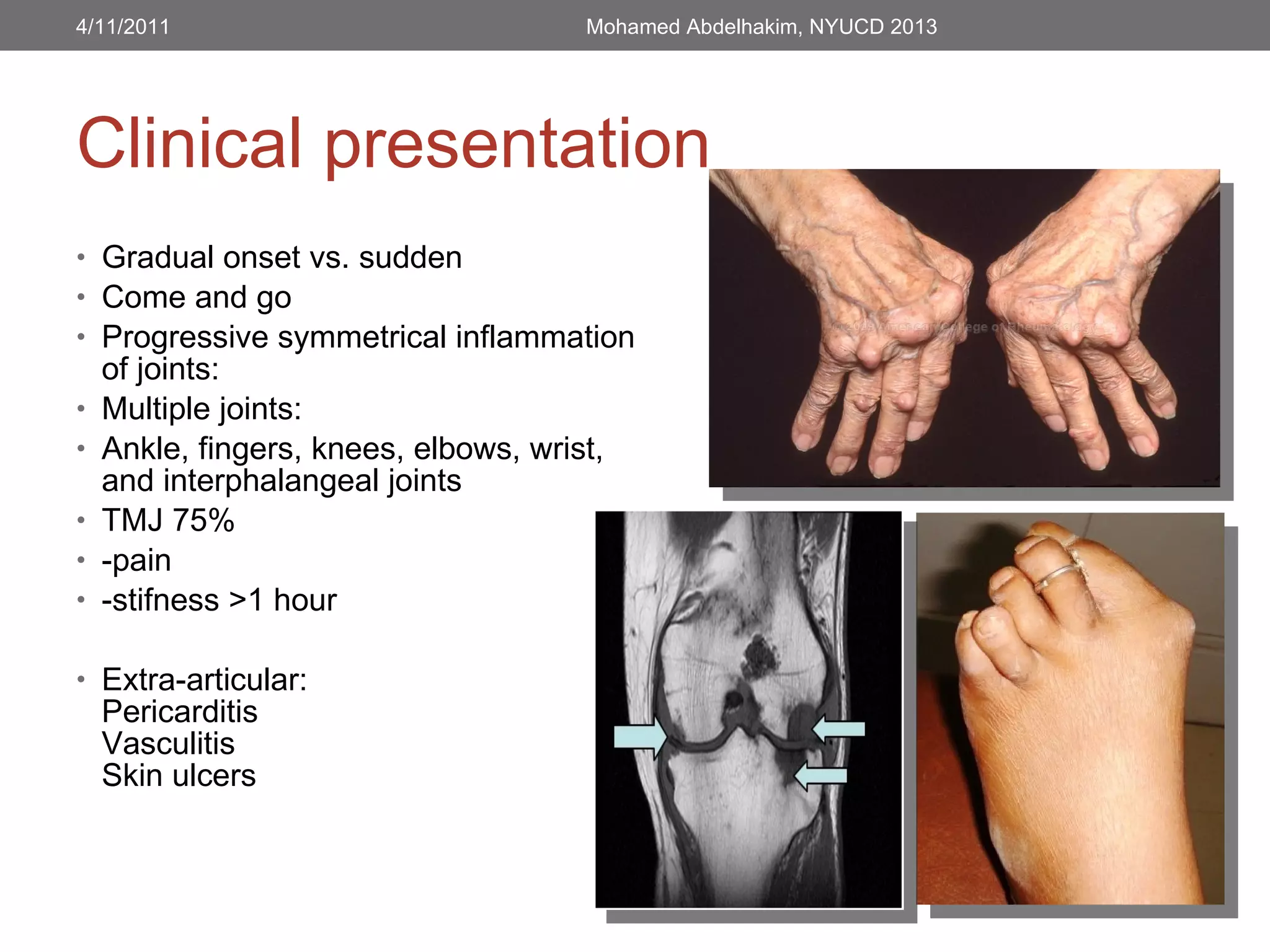 rheumatological diseases | PPT