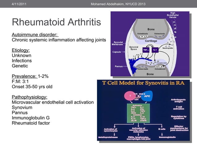 rheumatological diseases | PPT | Dental Health | Diseases and Conditions