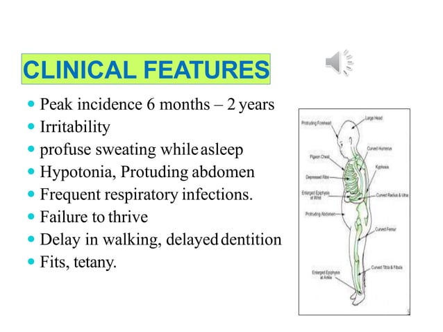 RICKETS IN CHILDREN | PPTX | Bone and Joint Conditions | Diseases and ...