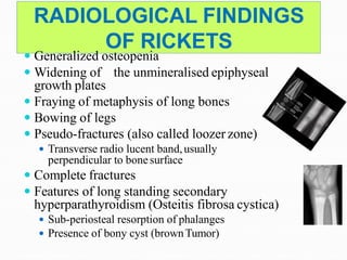 RICKETS IN CHILDREN | PPTX