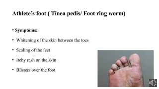 The second part of fractures in children | PPTX