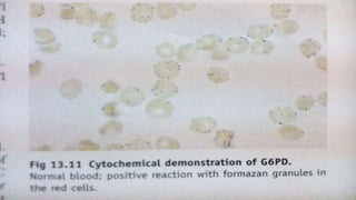 special stains in hematology and cytology | PPTX