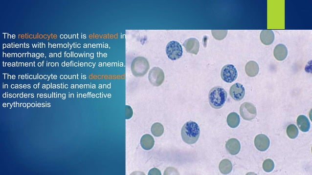 special stains in hematology and cytology | PPTX