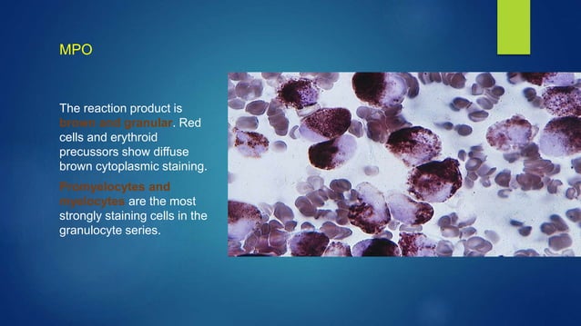 special stains in hematology and cytology | PPTX