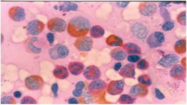 special stains in hematology and cytology | PPTX