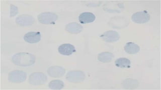 special stains in hematology and cytology | PPTX