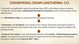 2 Stage Crown Lengthening VS 1 Stage Journal Presentation | PPTX