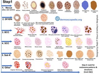 Características dermatosocpicas lesiones malignas dermoscopedia.org