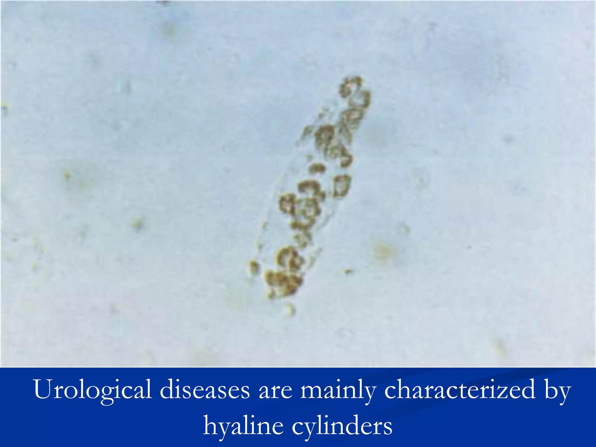 Symptomology and methods of physical examination of urological diseases ...