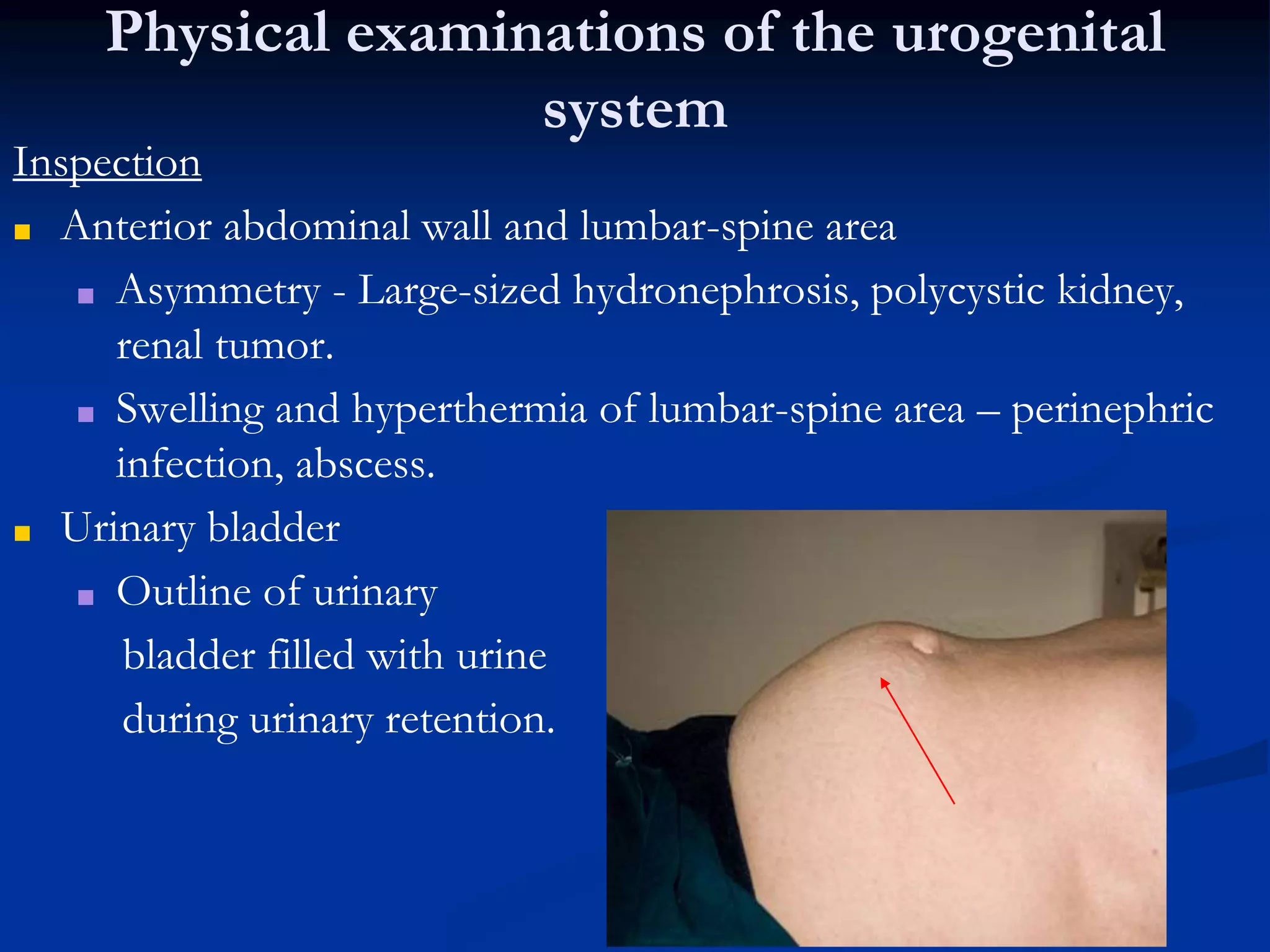 Symptomology and methods of physical examination of urological diseases ...