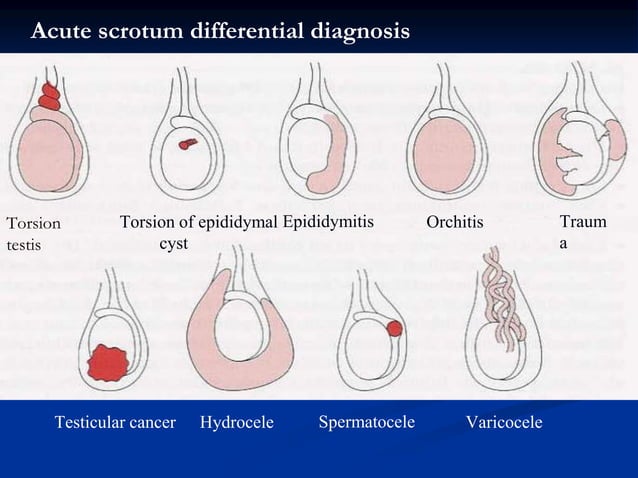 Symptomology and methods of physical examination of urological diseases ...