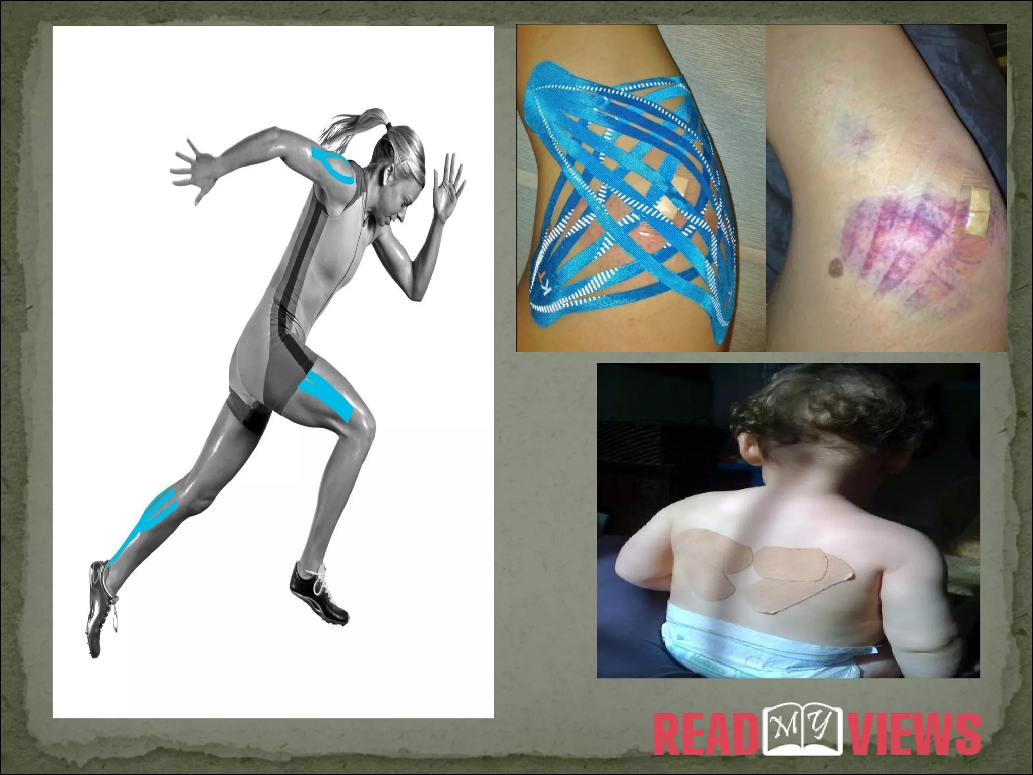 Taping in Physiotherapy | PPT