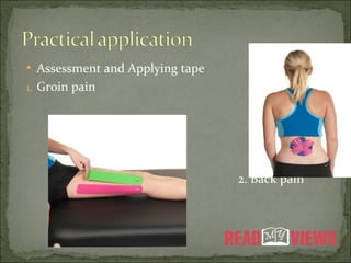 Taping in Physiotherapy | PPT