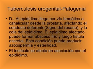 2 tbc urogenital | PPT