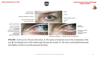 2 The orbital region part 1.pdf