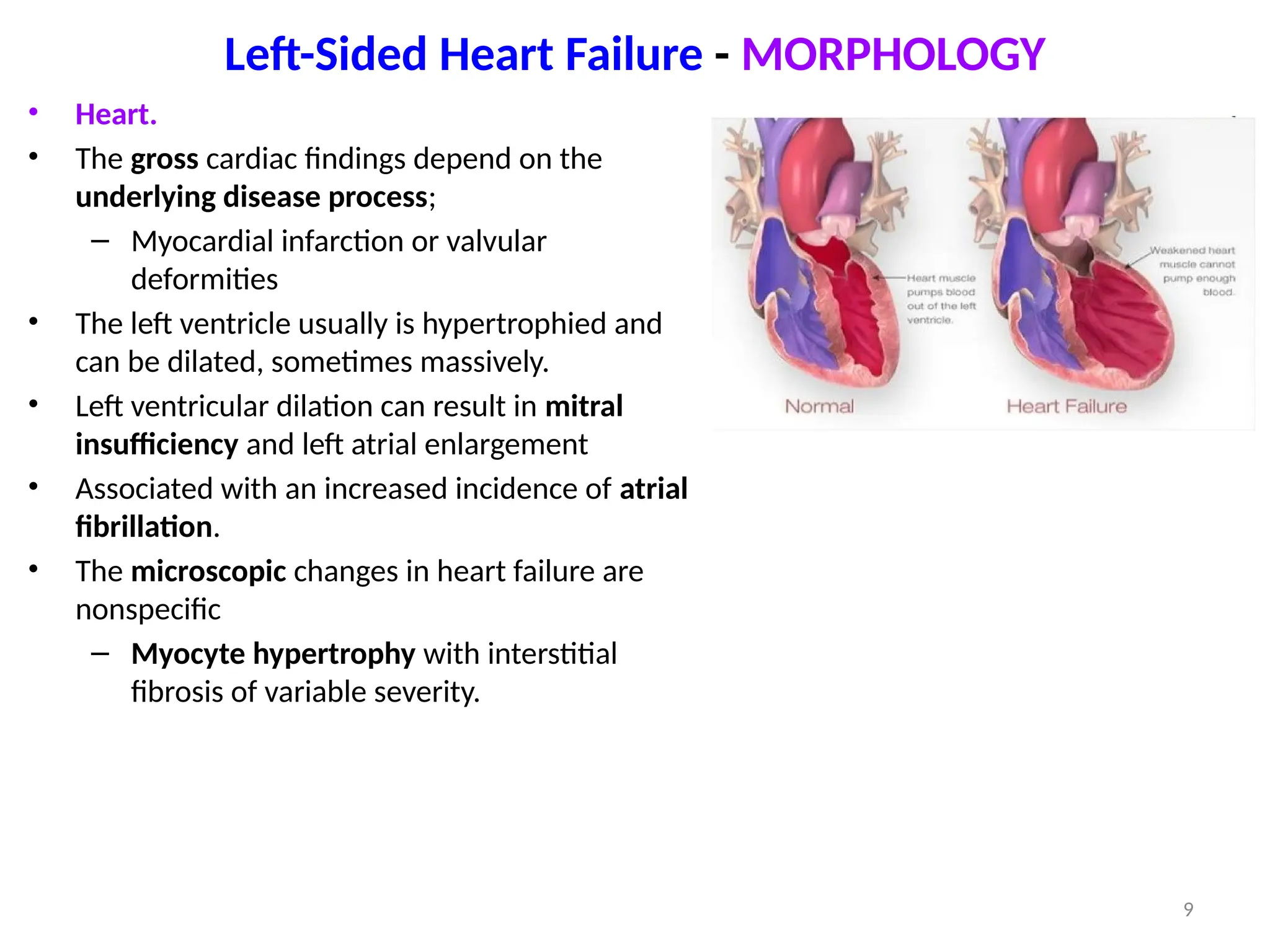 222 The pathology of the heart 2022.pptx