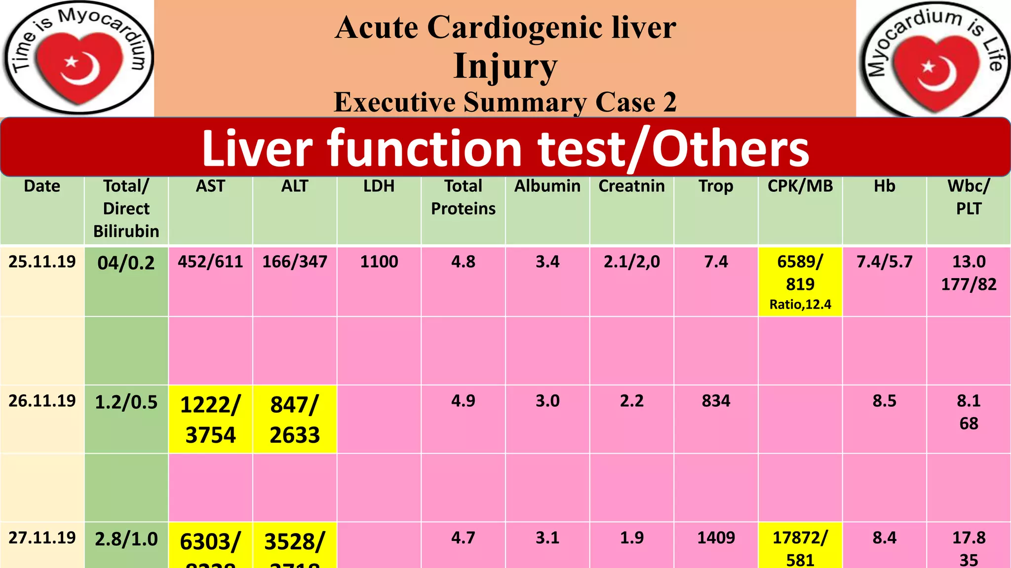 When Heart kills liver | PPT