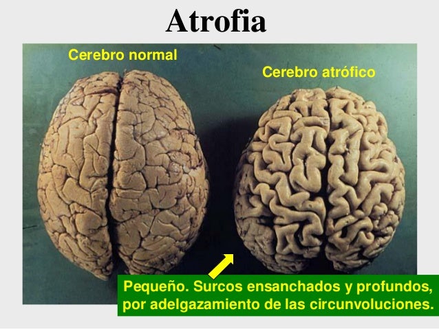 2 tp lesión, adaptación y diferenciación celular
