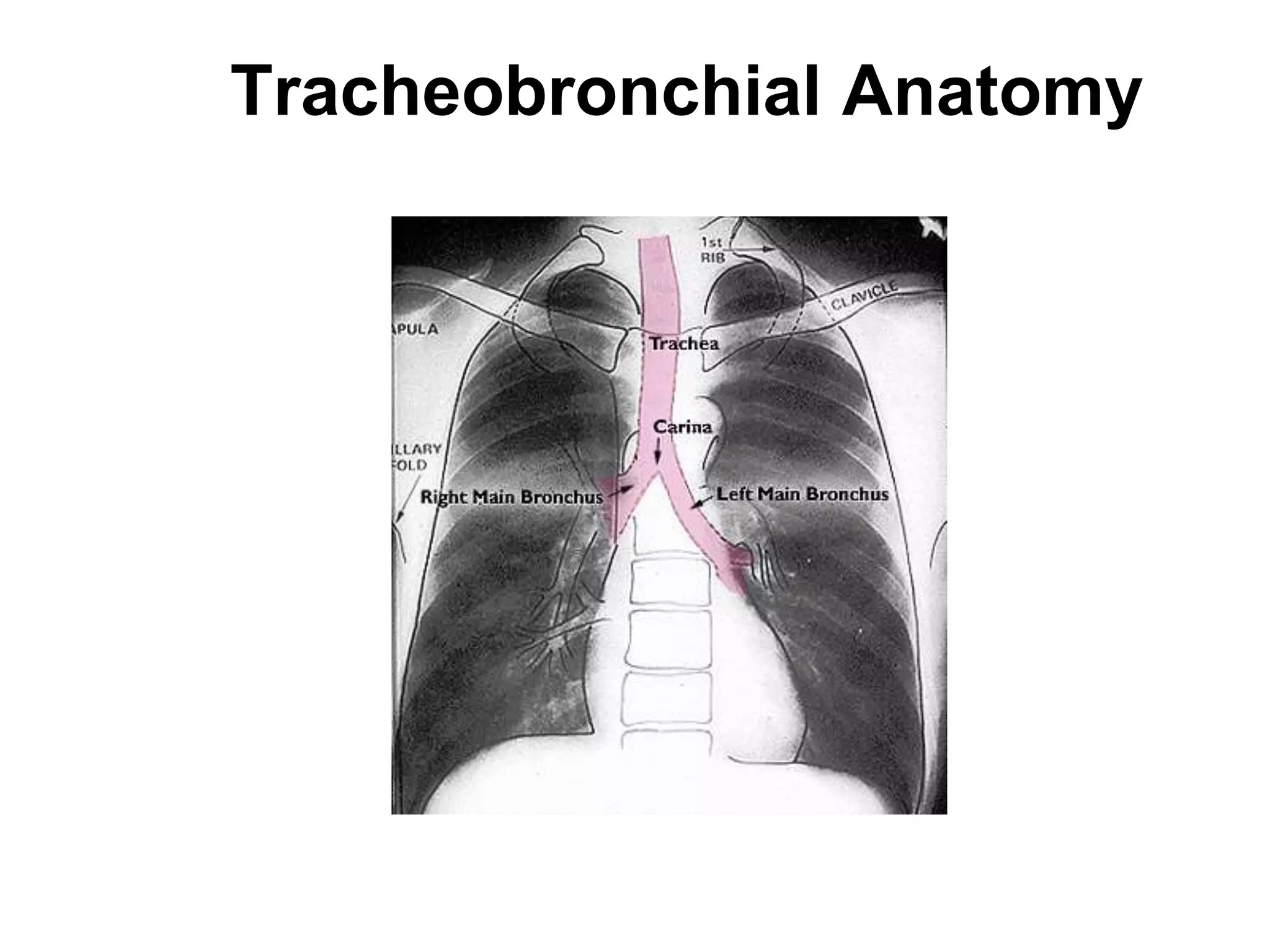 2@trachea and larynx | PPT | Thyroid Disorders | Endocrine and ...