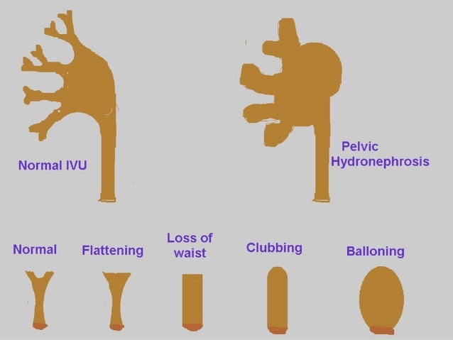 (2) urology & vascular