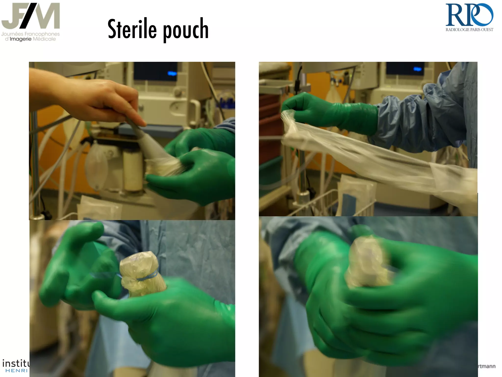 US Guidance venous access puncture in chest port imlantation . Luc ...