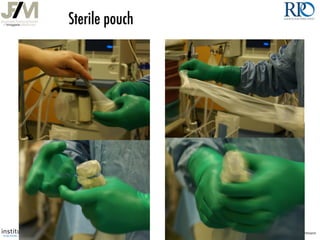 US Guidance venous access puncture in chest port imlantation . Luc ...