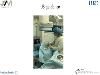 US Guidance venous access puncture in chest port imlantation . Luc ...