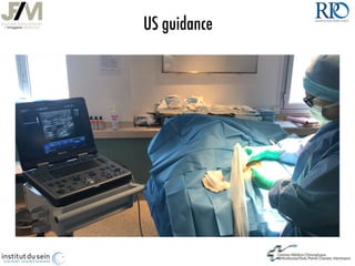 US Guidance venous access puncture in chest port imlantation . Luc ...