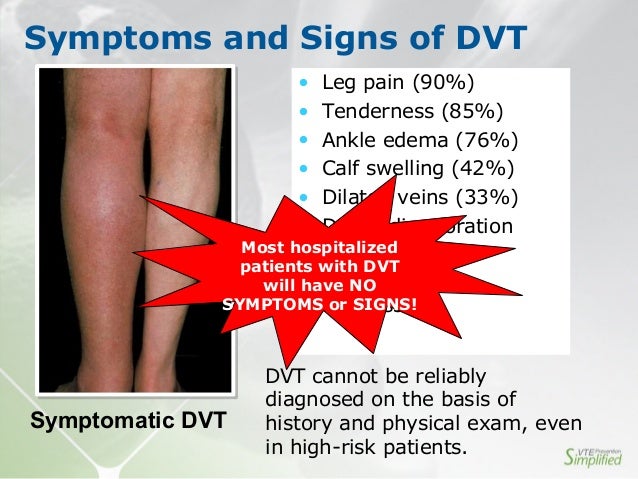 Vte Prophylaxis Focus On Prevention