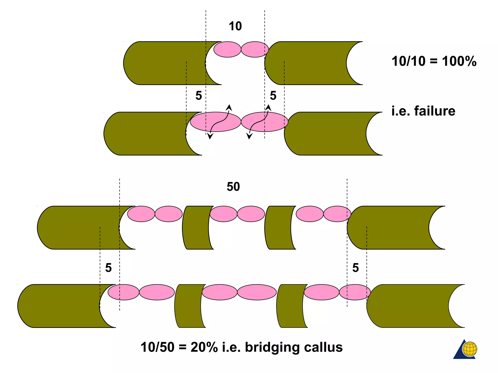 Biomechanics and biology of relative stability | PPT