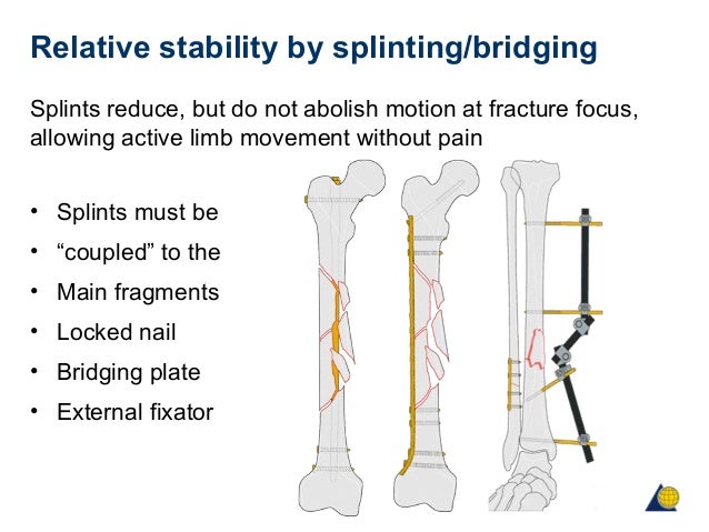 Biomechanics and biology of relative stability