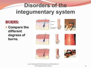 Functions and disorders of the Integumentary System | PPTX