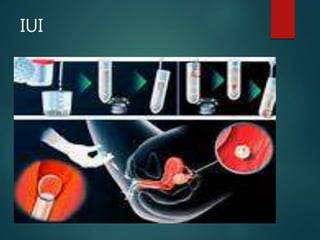 Comon-gyn.-procedure | PPT