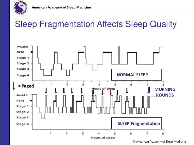 Sleep Disordered Breathing