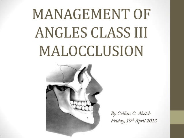 3.management of angles class iii malocclusion | PPTX | Dental Health ...