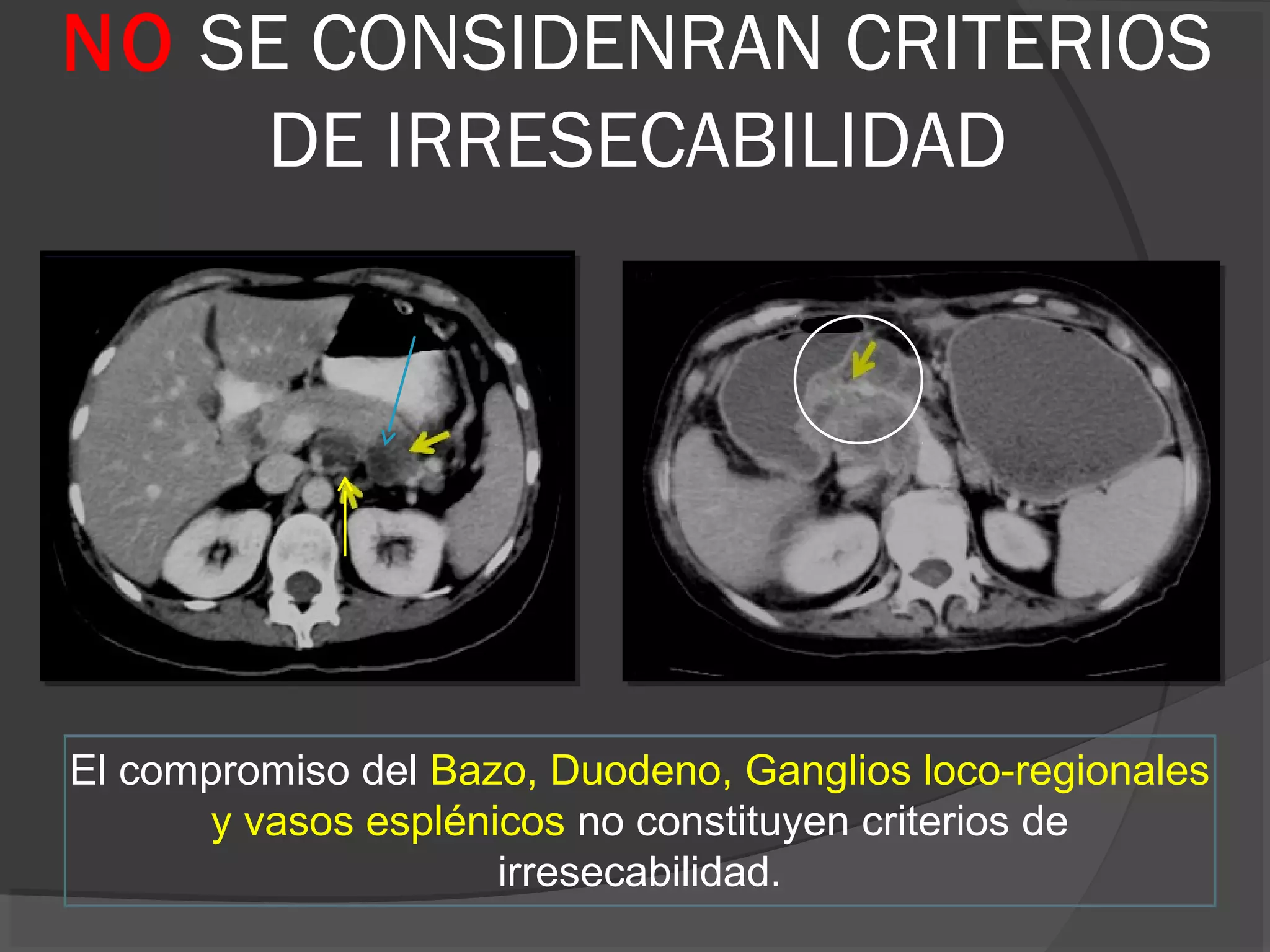 Clase de pancreas - TC | PPT