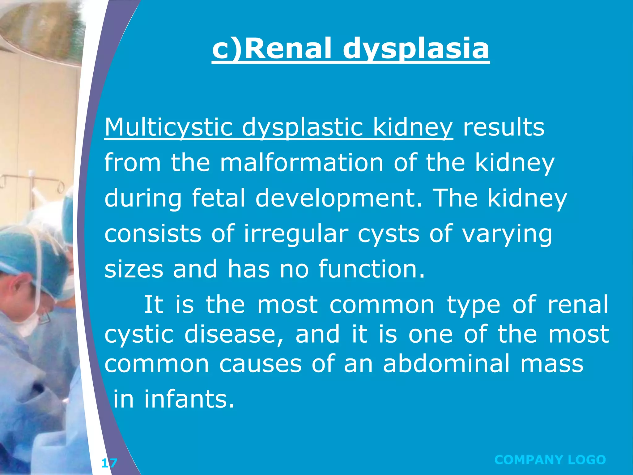 congenital anomalies of renal system | PPSX