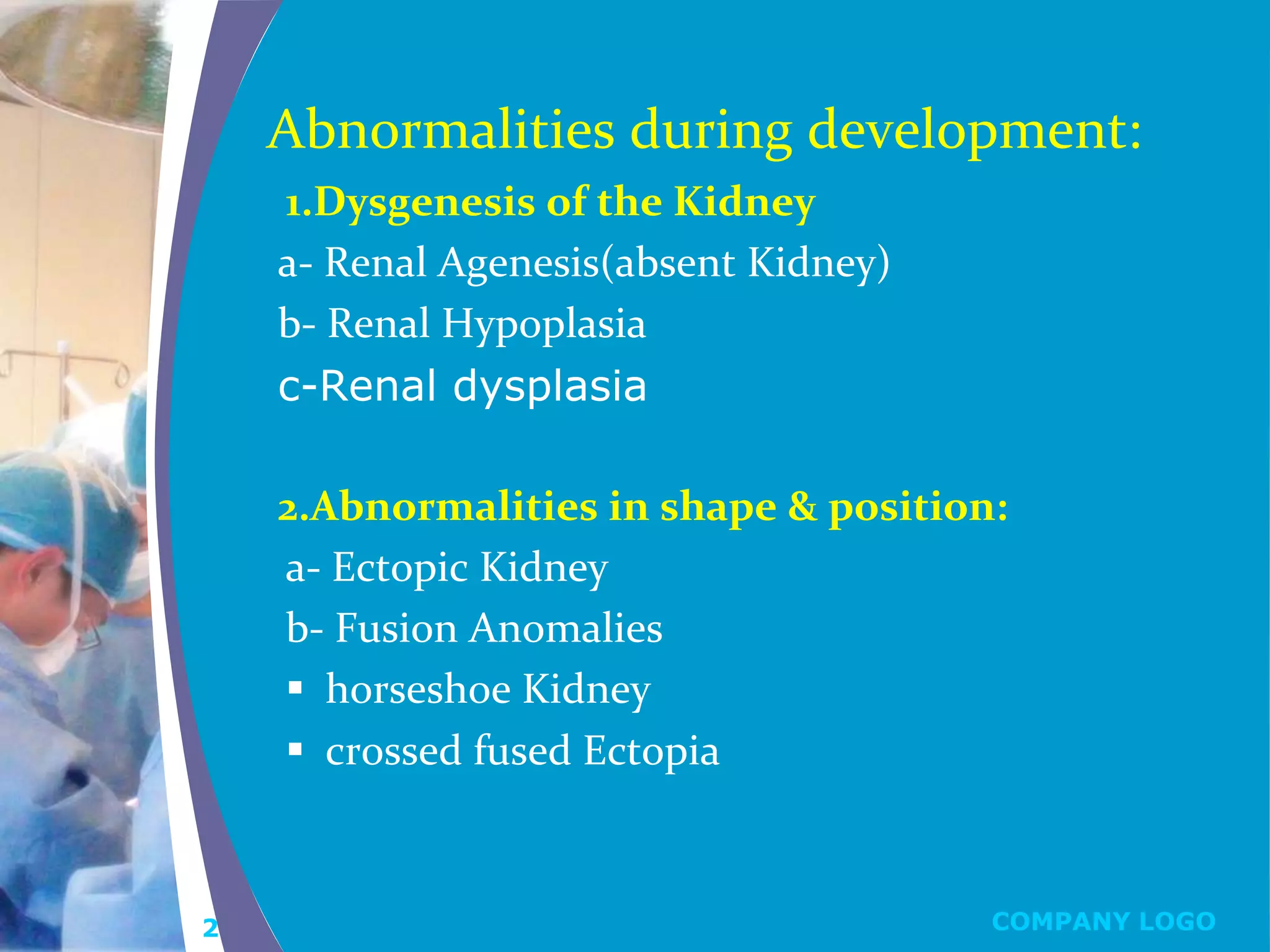 congenital anomalies of renal system | PPSX